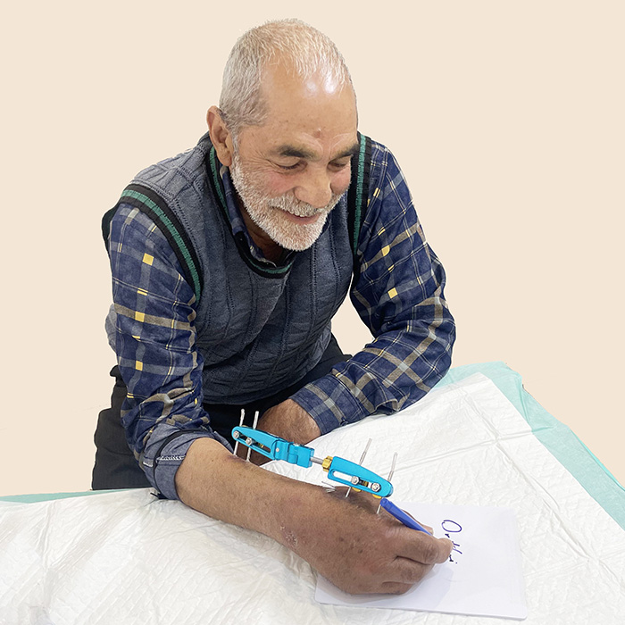 Dynamic Distal Radius External Fixator